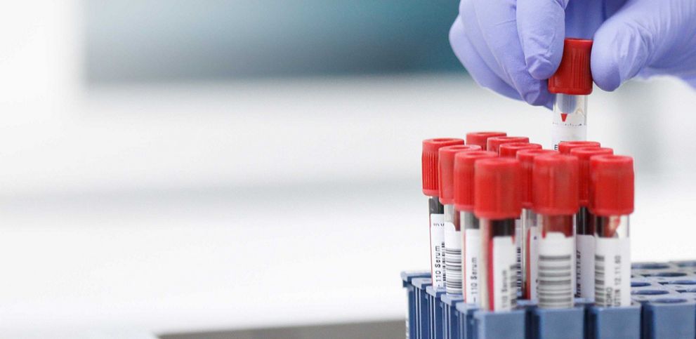 La risposta di Roche alla pandemia COVID-19