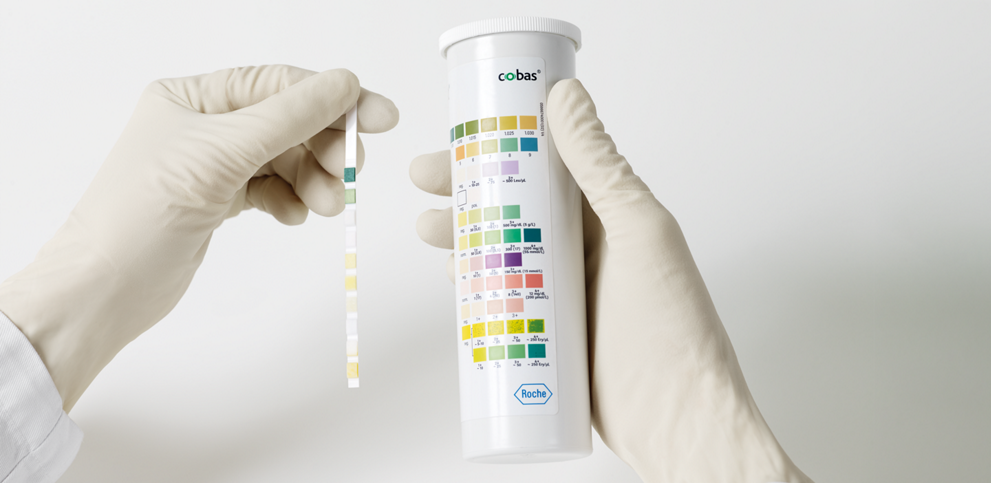 Celebrating 50 years of Combur-Test® strip technology from Roche