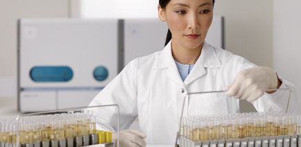 cobas® 6500 urine analyzer series