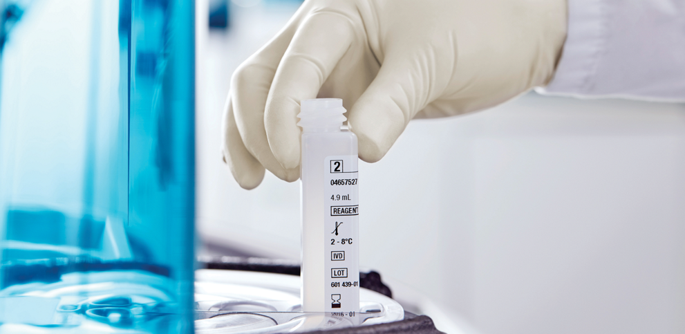 cobas c 111 analyzer