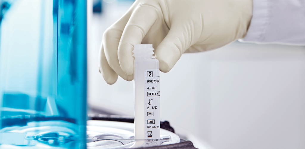 cobas c 111 analyzer