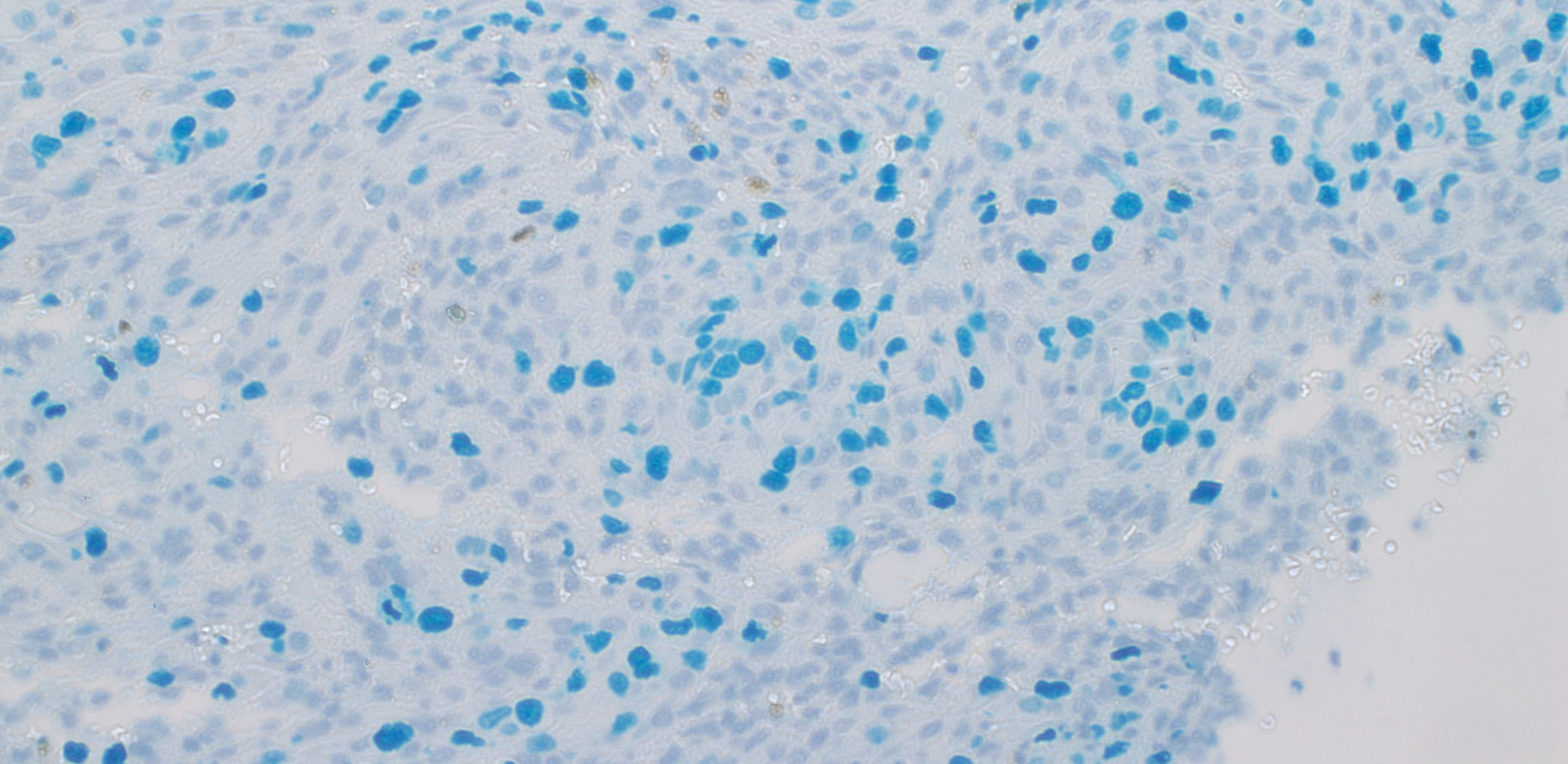 Roche lanza el kit de detección cromógeno DISCOVERY Teal PRP para ...