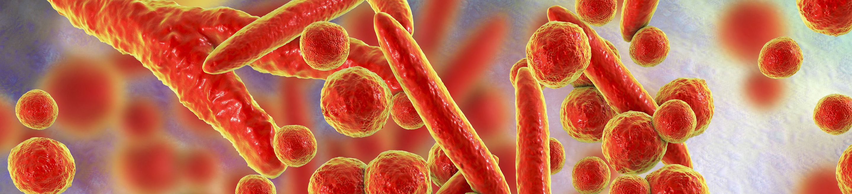 Mycoplasma Genitalium (MG)