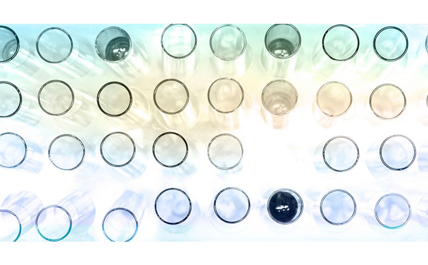 PCR検査機器｜ロシュ・ダイアグノスティックス