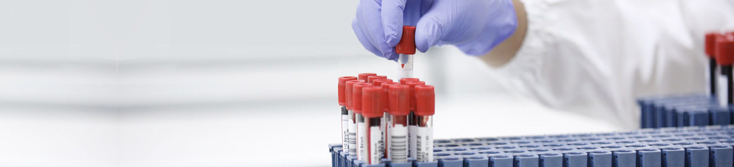 Workflow Efficiency in Molecular Diagnostics