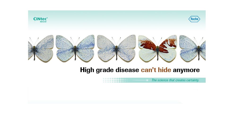 CINtec® p16 Histology 病理医向け判定トレーニング | ロシュ・ダイアグノスティックス