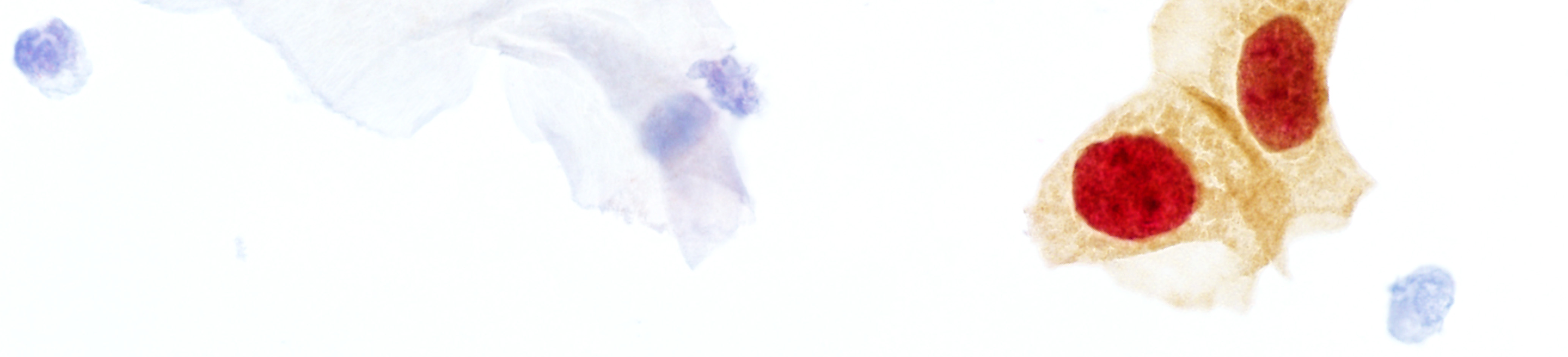 Roche recibe la aprobación de la FDA para la prueba de citología CINtec ...