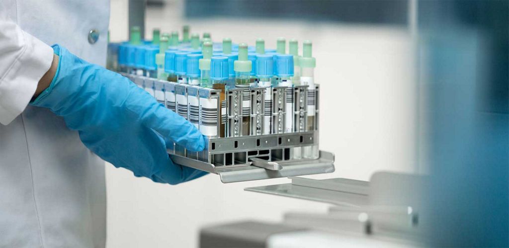 cobas t 511 coagulation analyzer