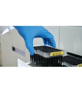 Système cobas® 5800