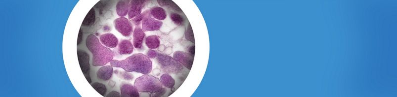 マイコプラズマ・ジェニタリウム (Mgen)