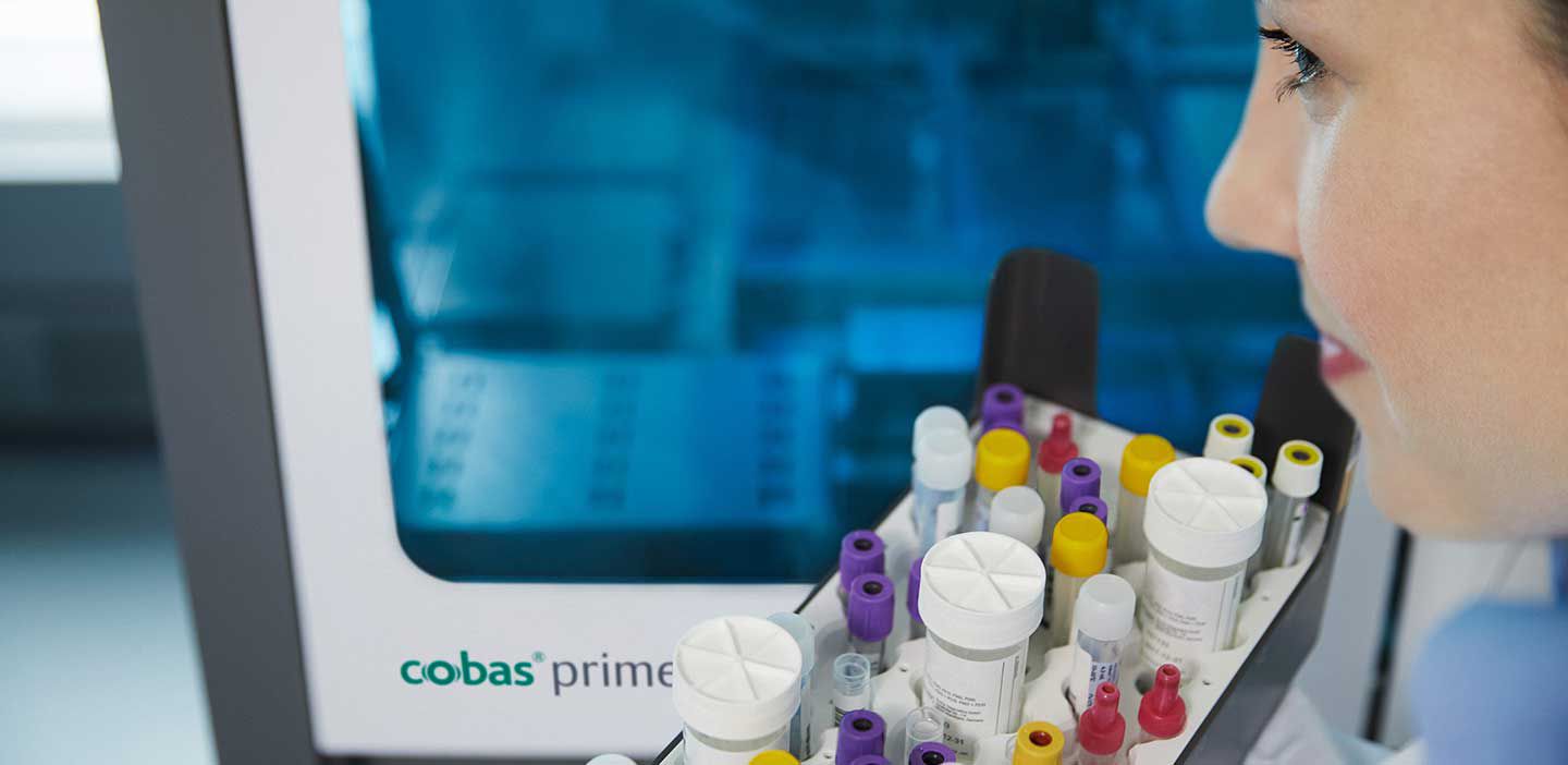 cobas® prime Pre-analytical System