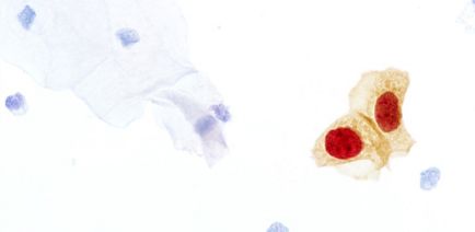 CINtec® PLUS Cytology Kit（ベンチマーク用） | ロシュ・ダイアグノスティックス