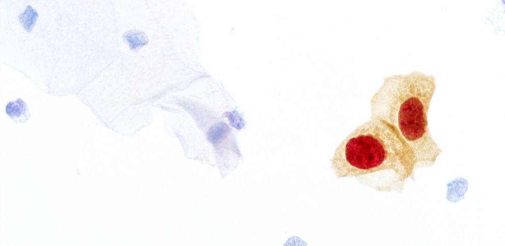 Test CINtec® PLUS Cytology