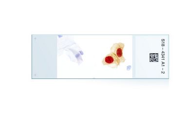 Roche recibe la aprobación de la FDA para la prueba de citología CINtec ...