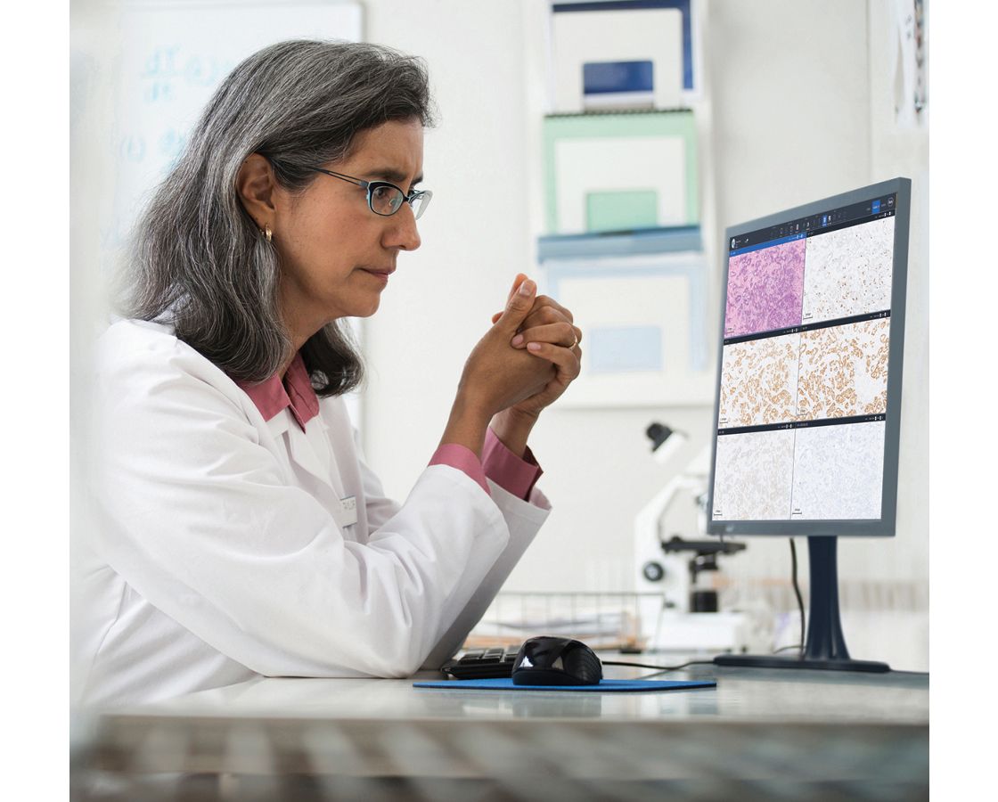 VENTANA DP 200 slide scanner