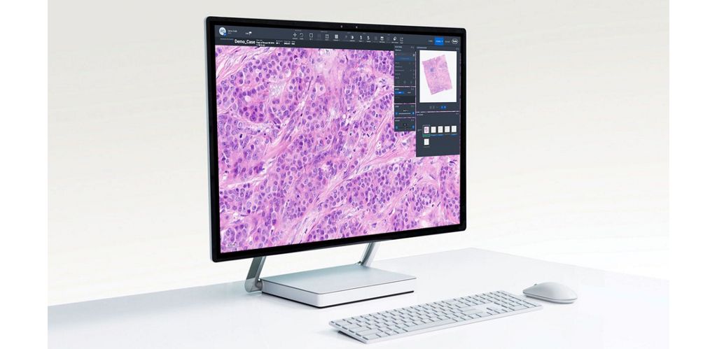 Roche uPath enterprise software