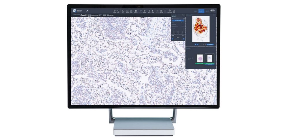 uPath HER2 Dual ISH Image Analysis, Breast CE-IVD