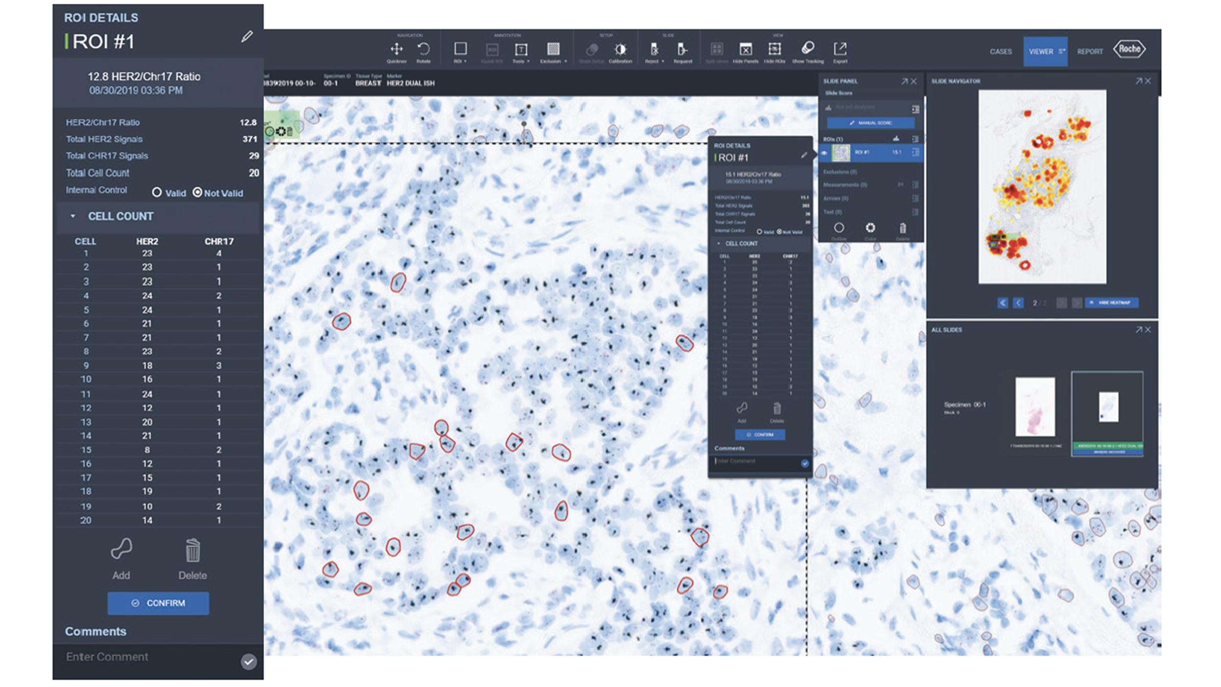 uPath HER2 Dual ISH image analysis, Breast for research