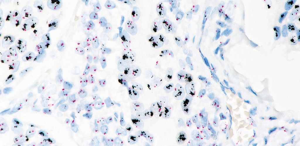 VENTANA HER2 Dual ISH DNA Probe Cocktail Assay (CE IVD)