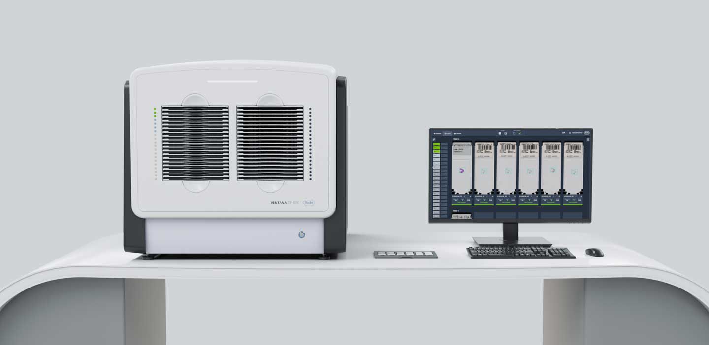 VENTANA DP 600 slide scanner