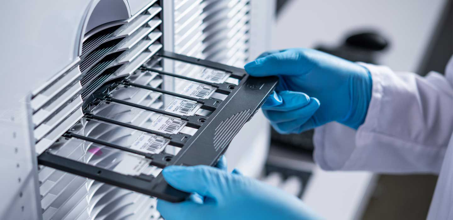 VENTANA DP 600 slide scanner