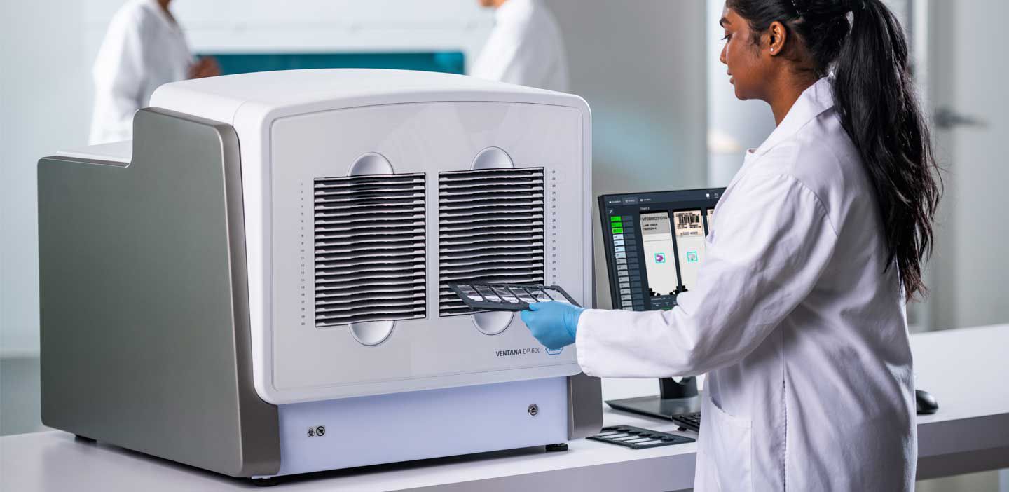 VENTANA DP 600 slide scanner