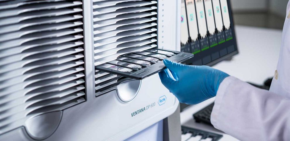 VENTANA DP 600 slide scanner