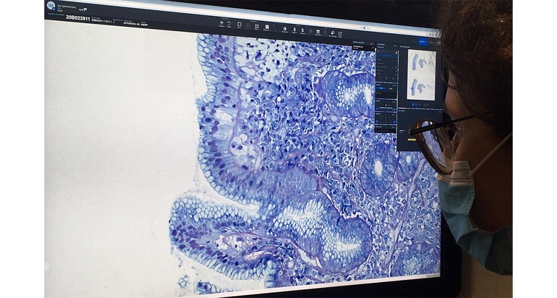 Patología digital en el Hospital del Mar