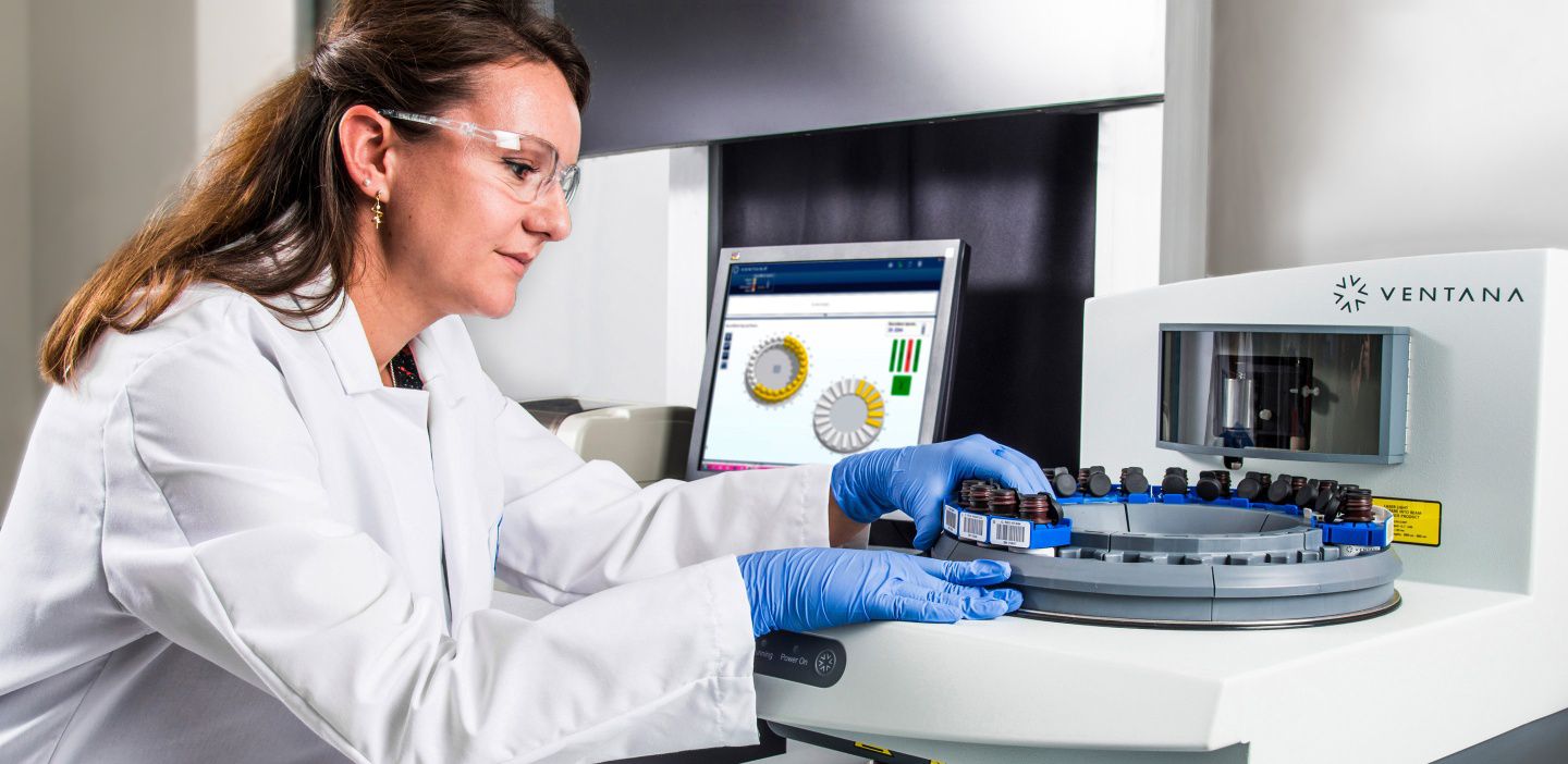 VENTANA BenchMark Special Stains system