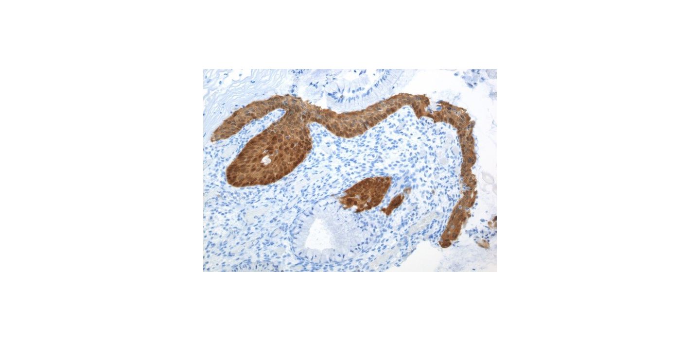 CINtec® Histologie