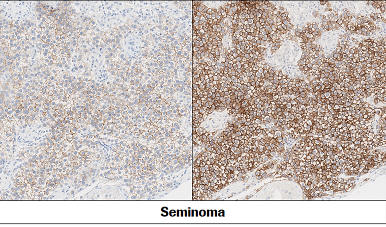 anti-CD117 (EP10) Rabbit Monoclonal Primary Antibody