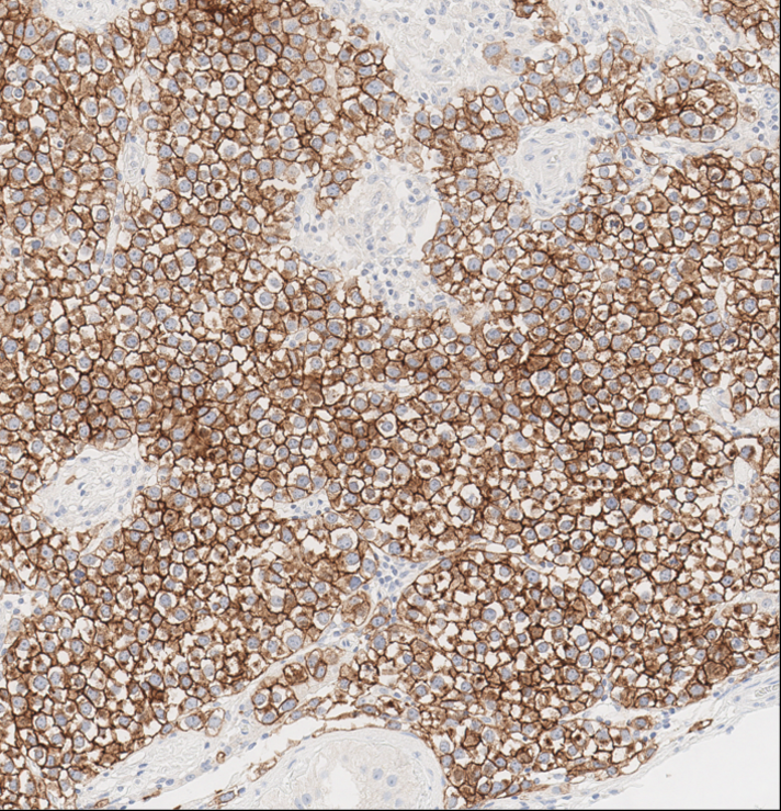 anti-CD117 (EP10) Rabbit Monoclonal Primary Antibody