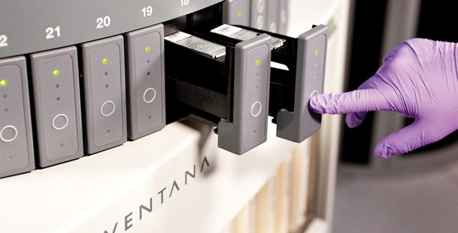 BenchMark ULTRA system