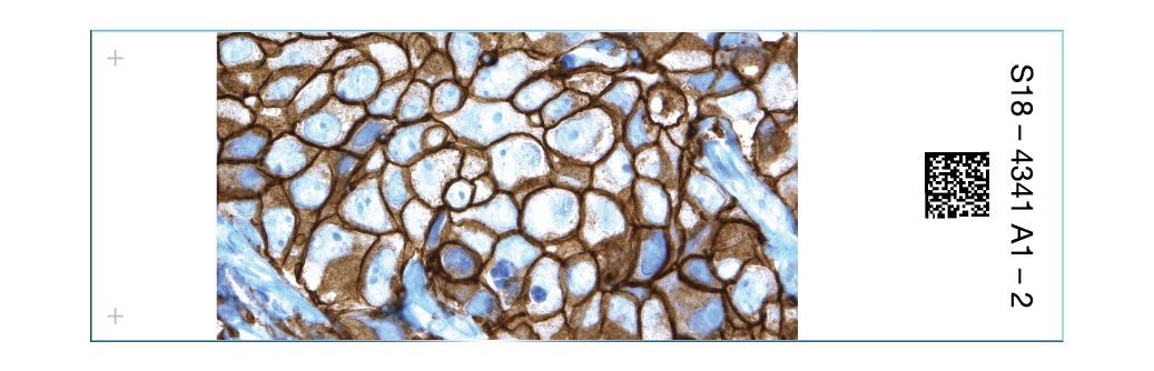 Breast cancer IHC portfolio