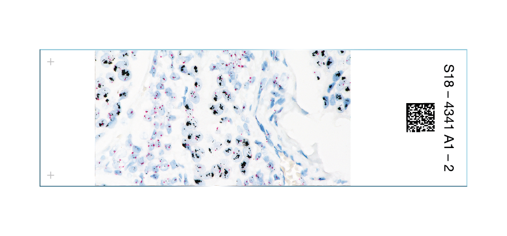 Breast cancer IHC portfolio