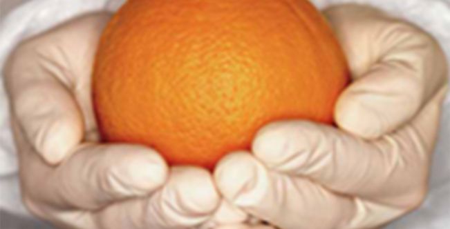 Chemstrip® Test Strips