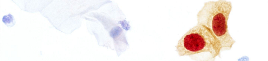 Тест CINtec® PLUS Cytology