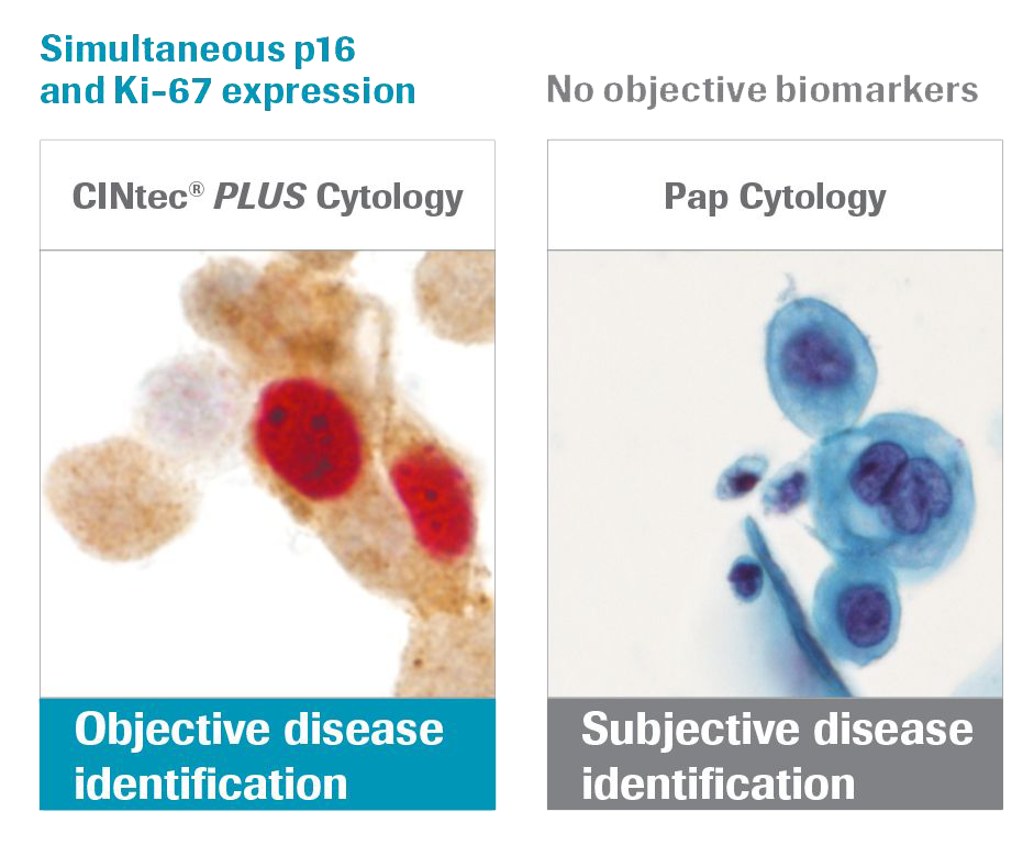 CINtec® PLUS Cytology