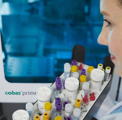 cobas® prime Pre-analytical System