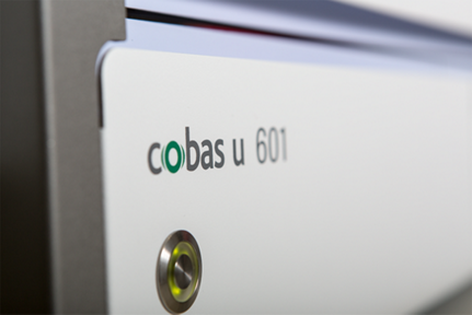 cobas u 601 urine analyzer