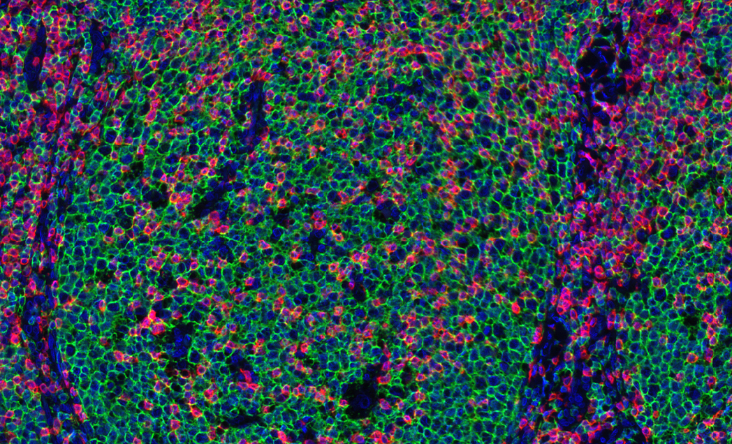 Immunohistochemistry Ihc Resources