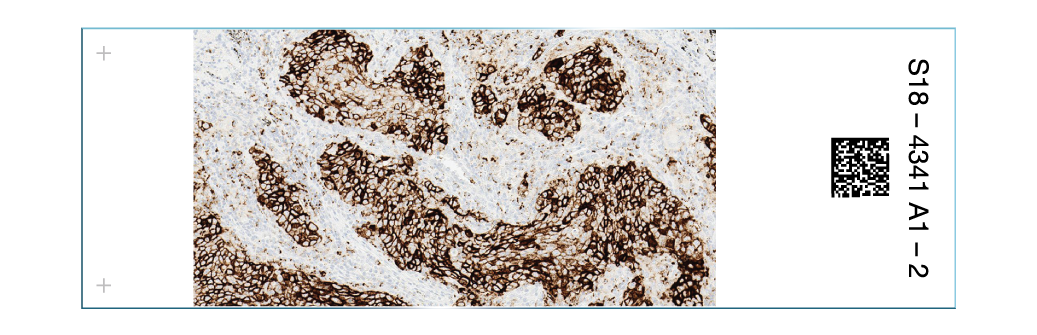 Lung cancer IHC portfolio