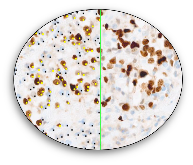 Upath Image Analysis Algorithms
