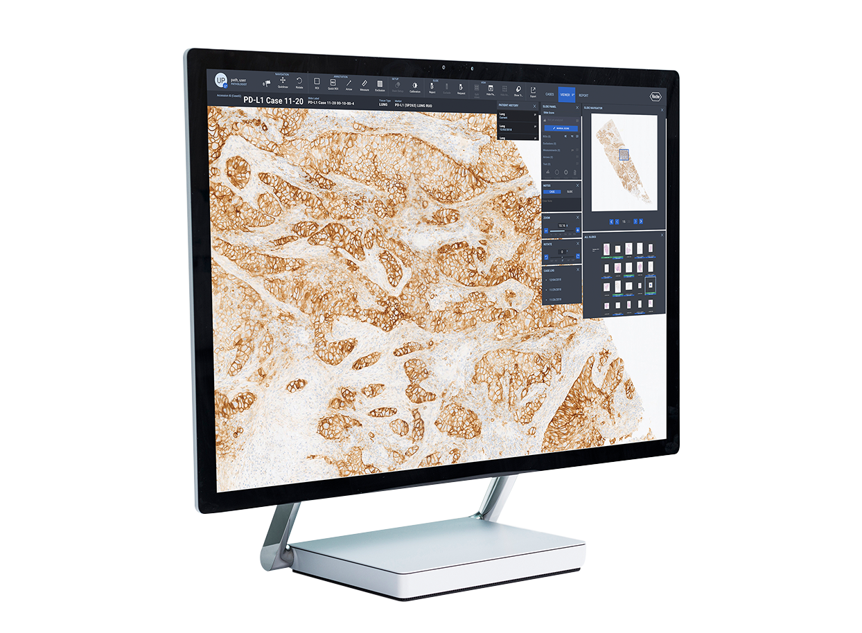 VENTANA PD-L1 (SP263) Assays