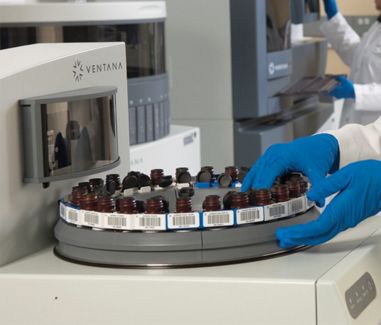 VENTANA BenchMark Special Stains system