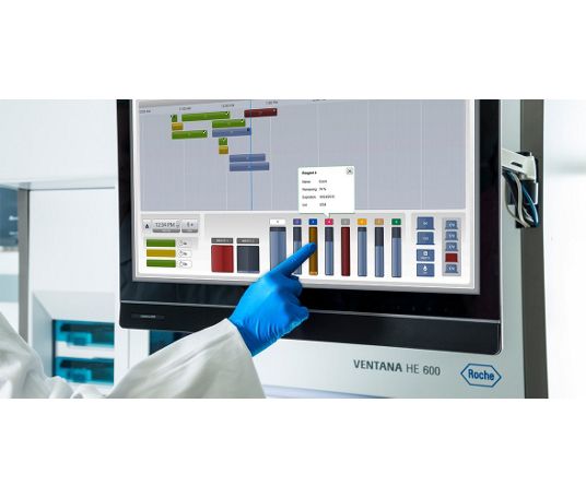 VENTANA HE 600 automated staining system