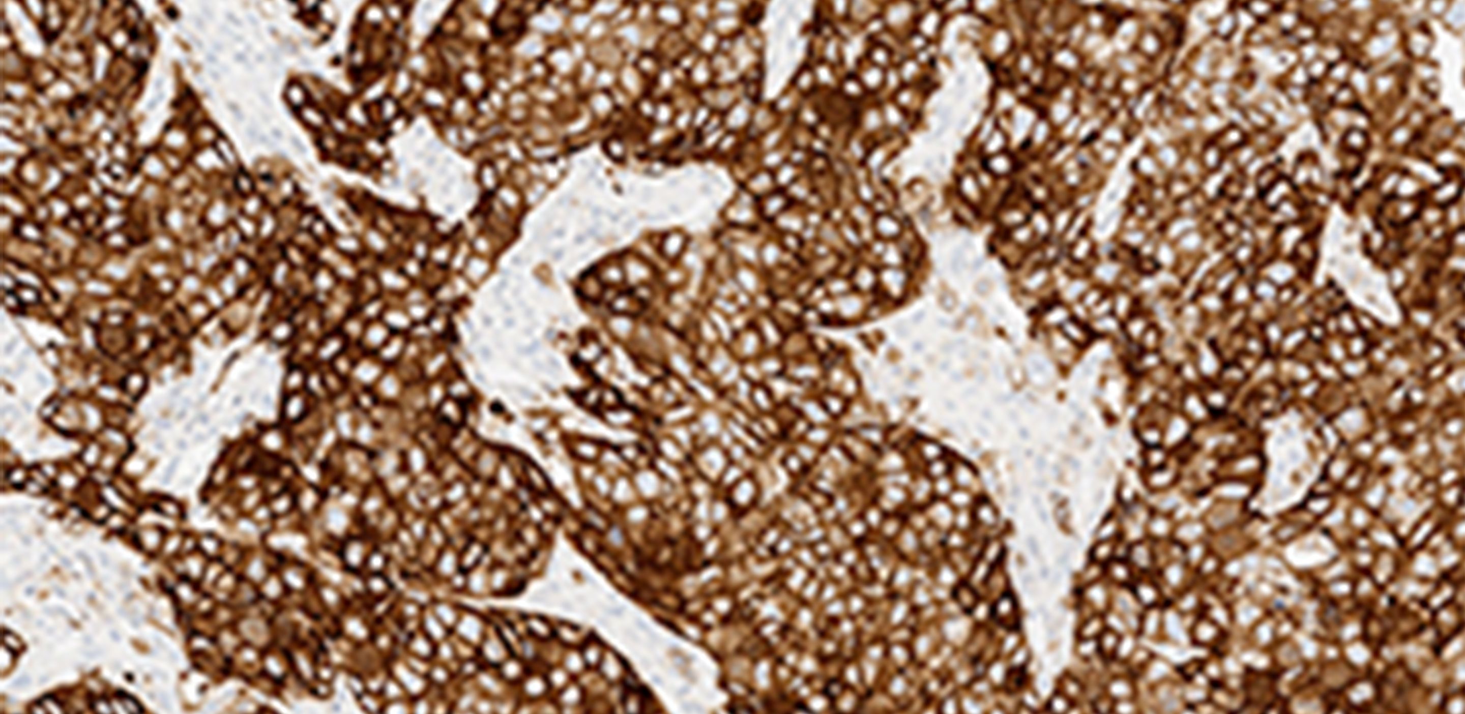 VENTANA PD-L1 (SP263) Assays