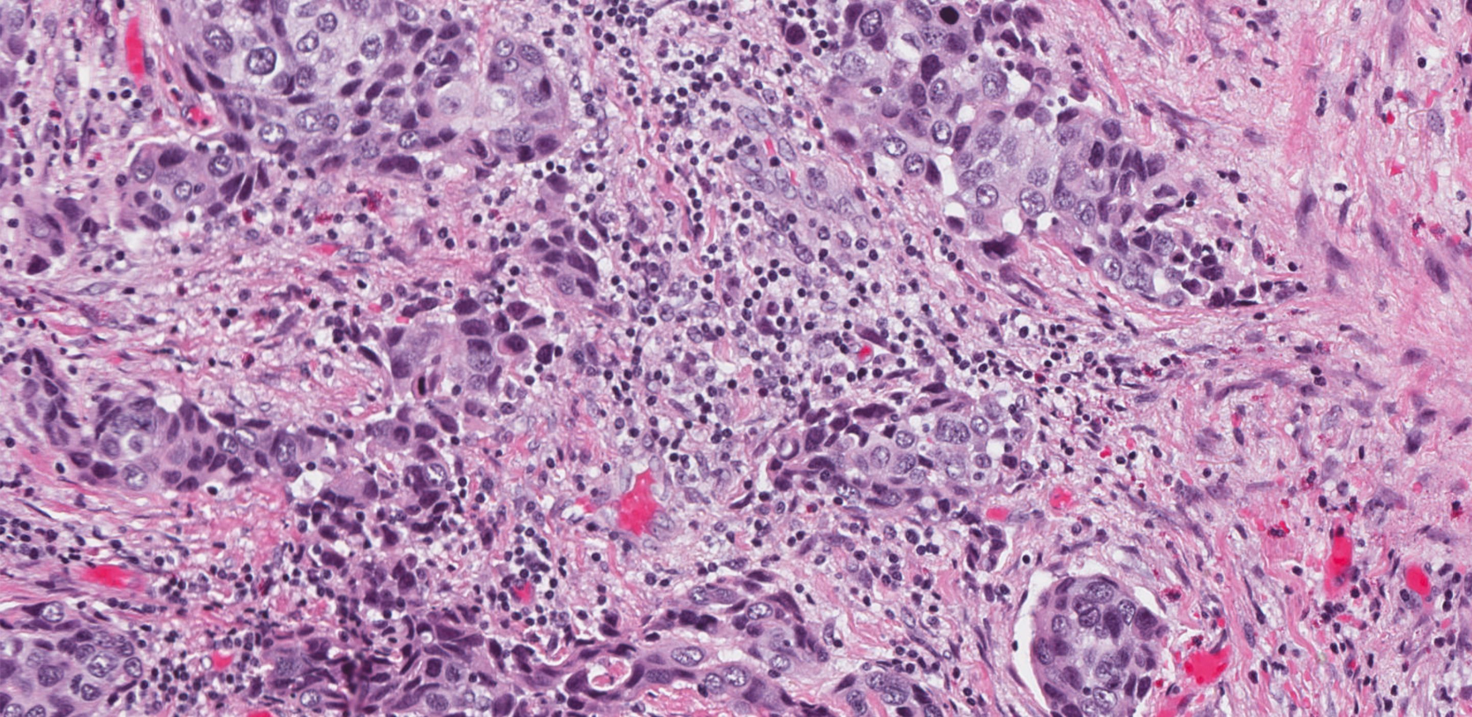 VENTANA PD-L1 (SP263) Assays