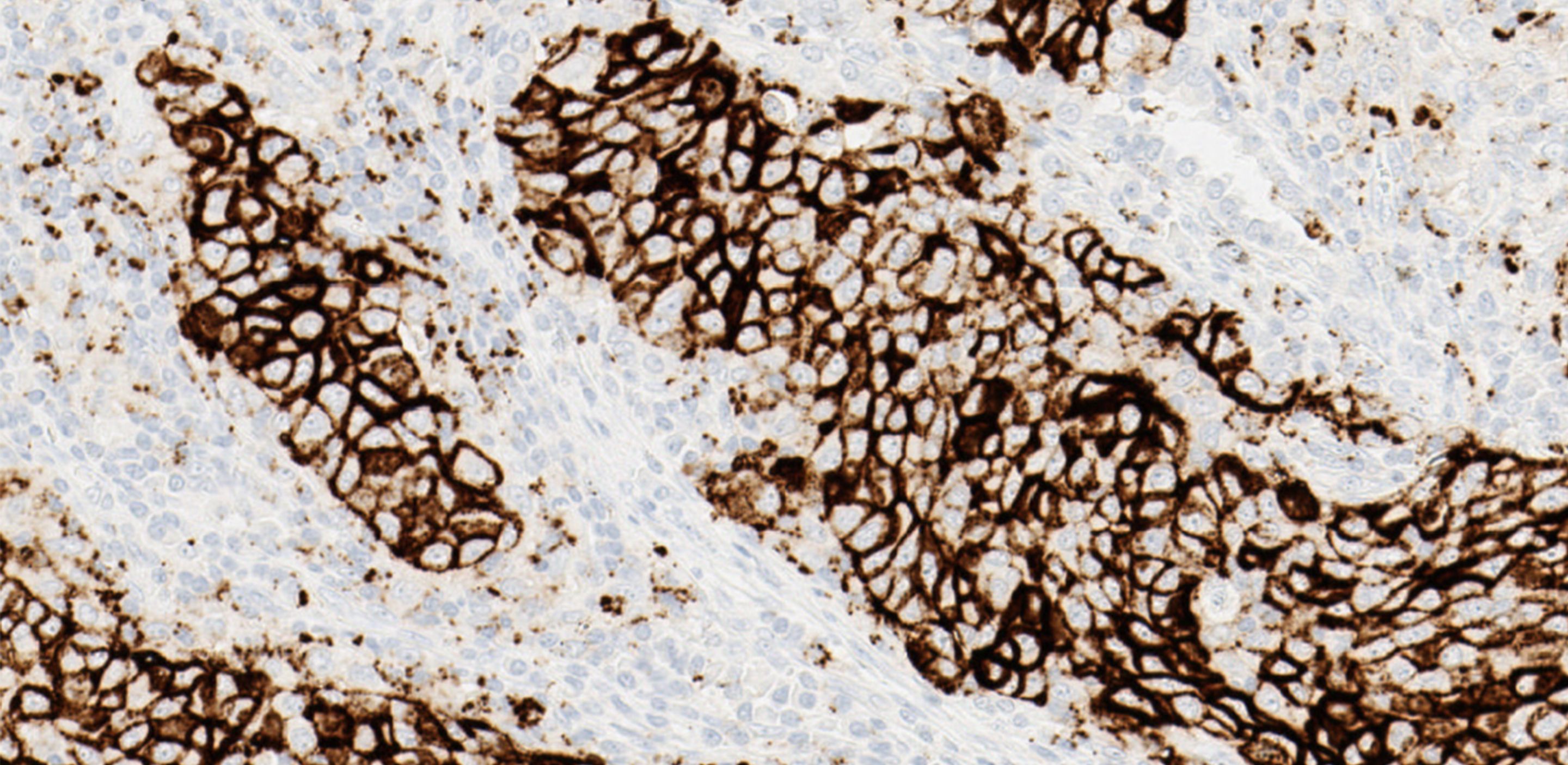 VENTANA PD-L1 (SP142) Assay