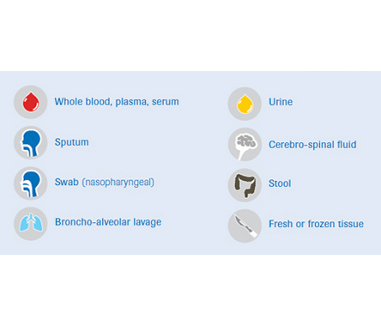 MagNA Pure 24 System